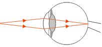Optical instrument human eye - Physics